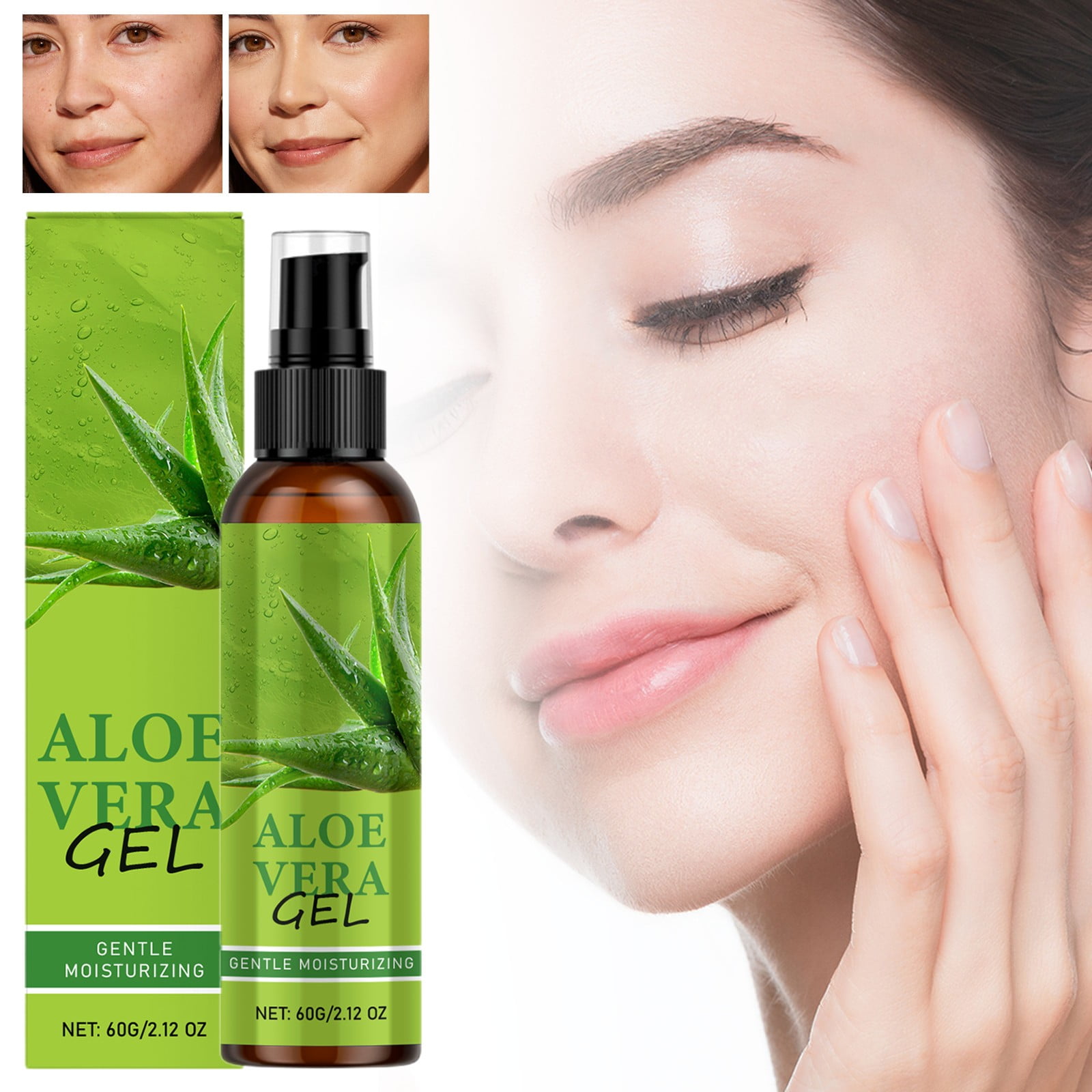 Aloe Vera Gel Spray | Instant Cooling Mist for Sunburns | No-Rub ...