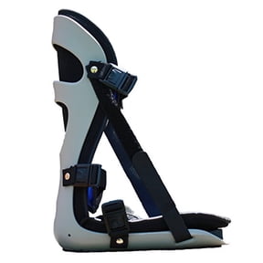 Orthoglass Splints