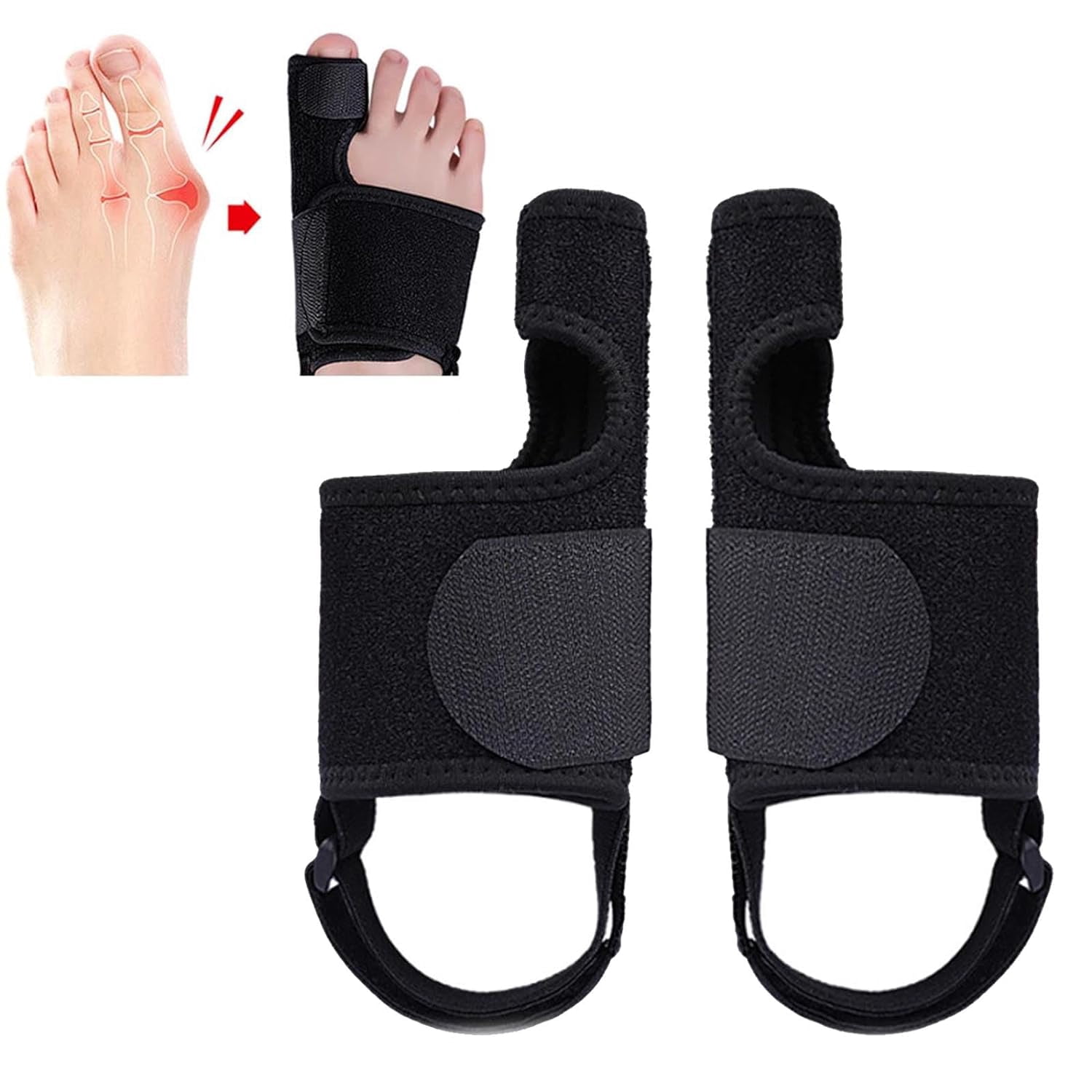 Alpha Sole Bunion Corrector, Alphasole Bunion Corrector, Alpha Sole ...