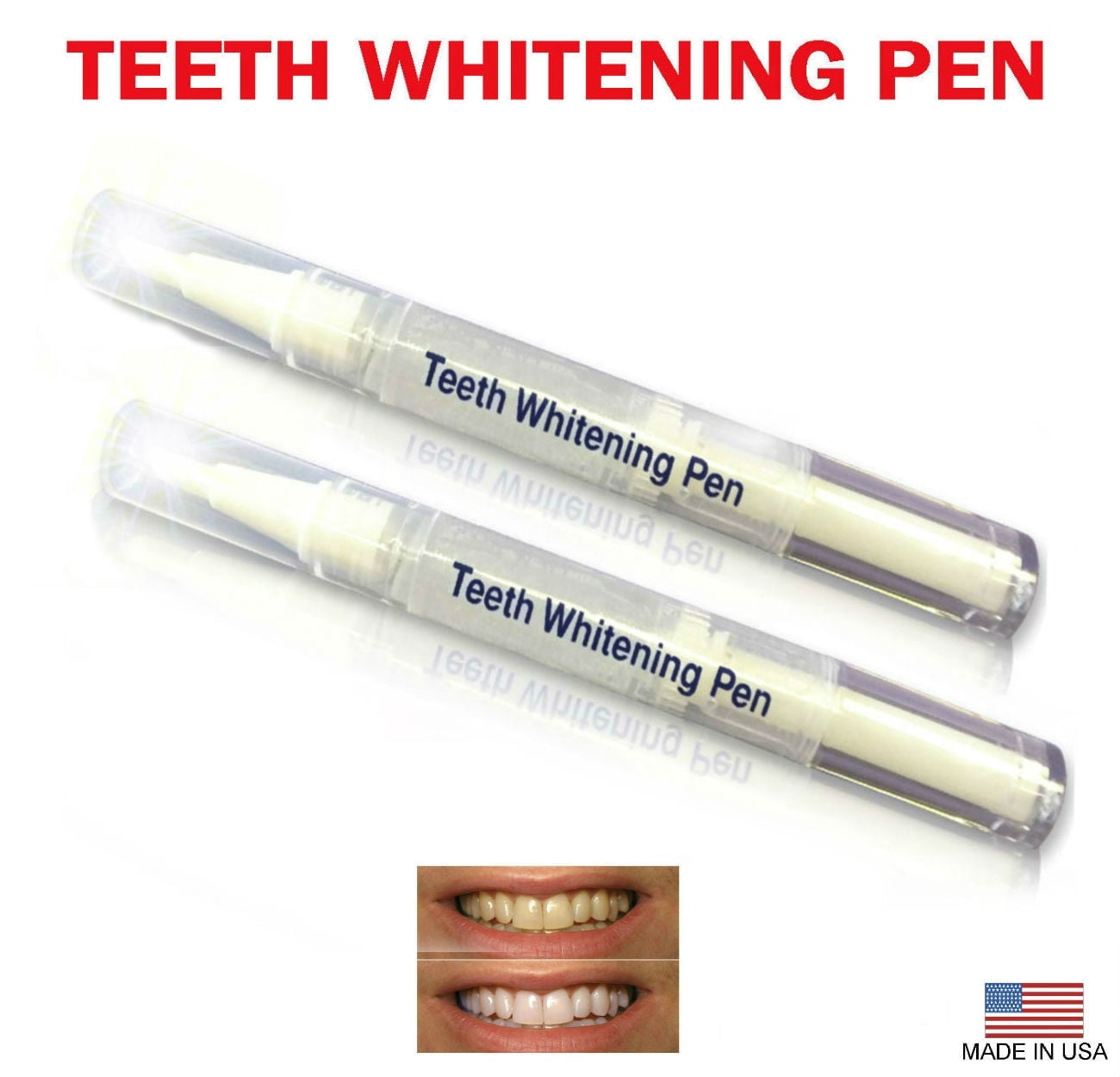 Always White Teeth Whitening Pens 22% White Gel Carbamide Peroxide ...