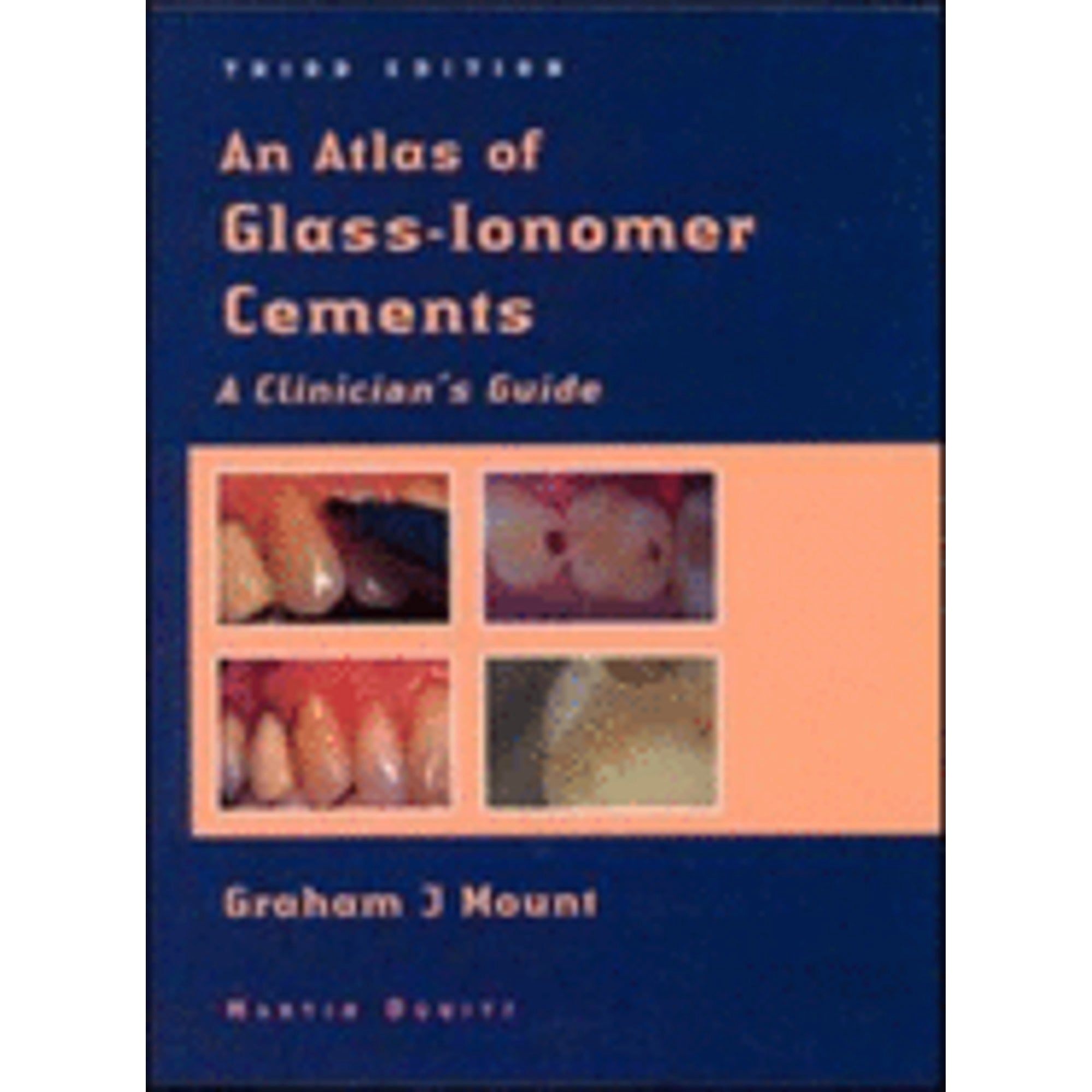 An Atlas of Glass-Ionomer Cements: A Clinician's Guide (Hardcover) by ...