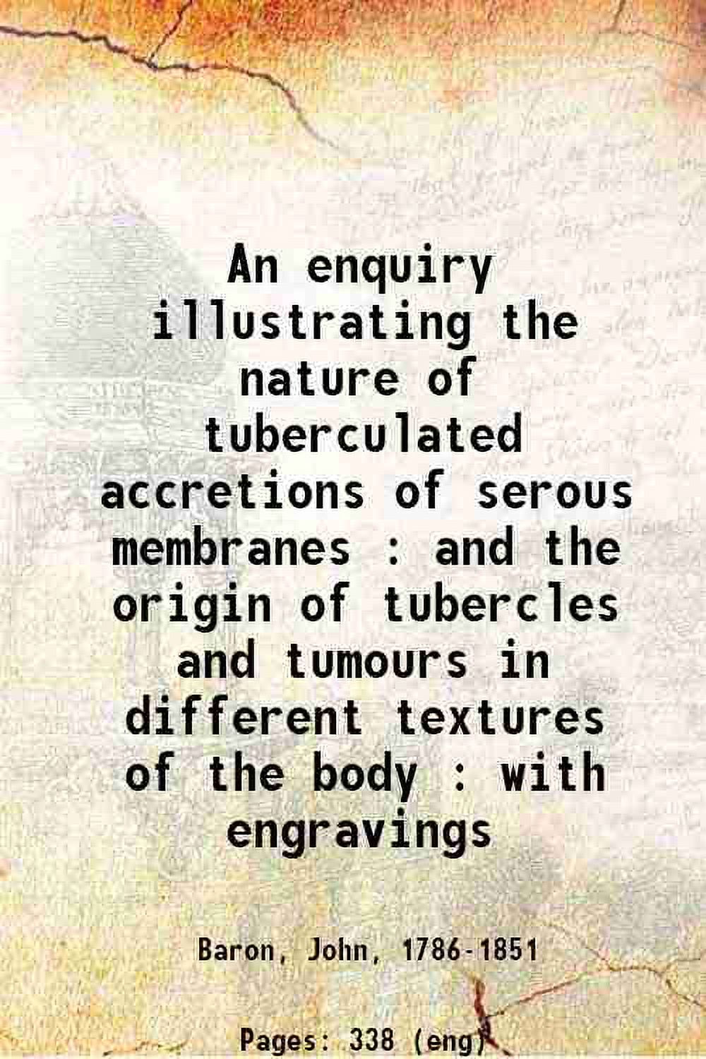 An enquiry illustrating the nature of tuberculated accretions of serous ...