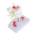 Anatomical Lumbar Disc Herniation Demonstration Model Human Spine ...