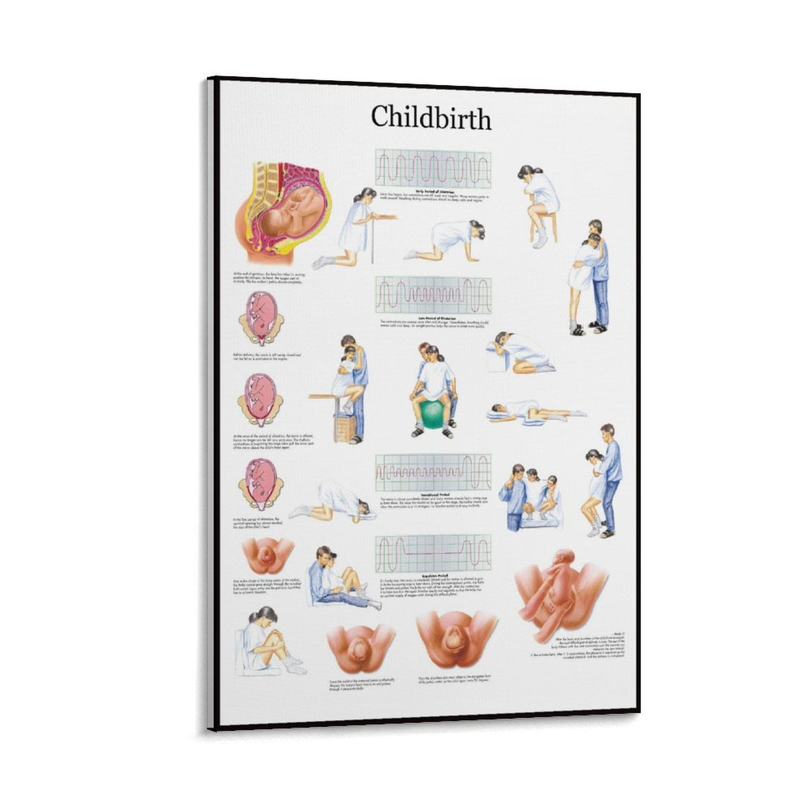 Anatomical Poster Childbirth Posters Print Photo Art Painting Canvas ...