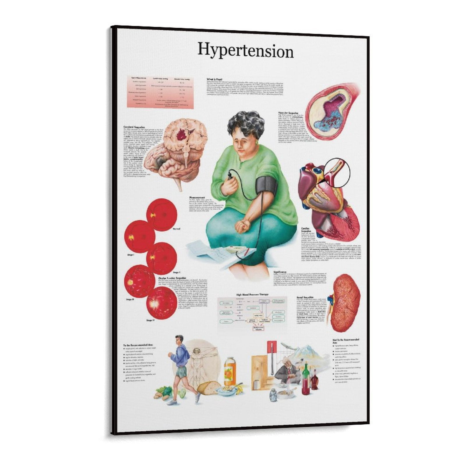 Anatomical Poster Hypertension Posters Art Poster Canvas Painting Decor ...