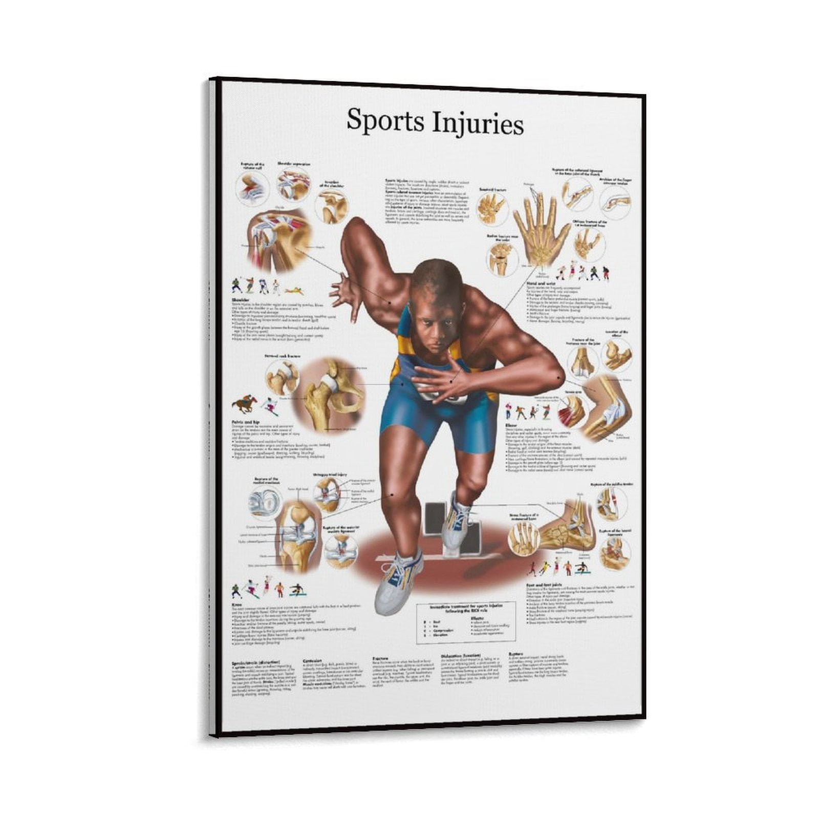Anatomical Poster Sports Injuries Posters Print Photo Art Painting ...