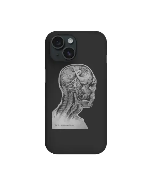 Anatomy of a Sad Skeleton Head Funny Medical Phone Case for iPhone 16 ...
