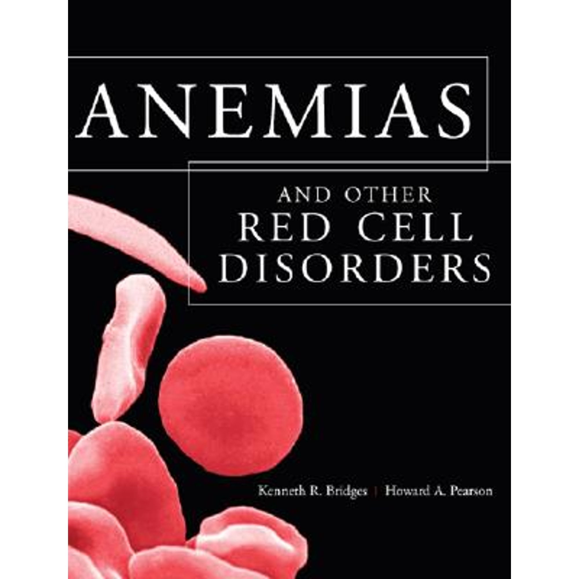 Pre-Owned Anemias and Other Red Cell Disorders (Hardcover) 0071419403 9780071419406 - Walmart.com