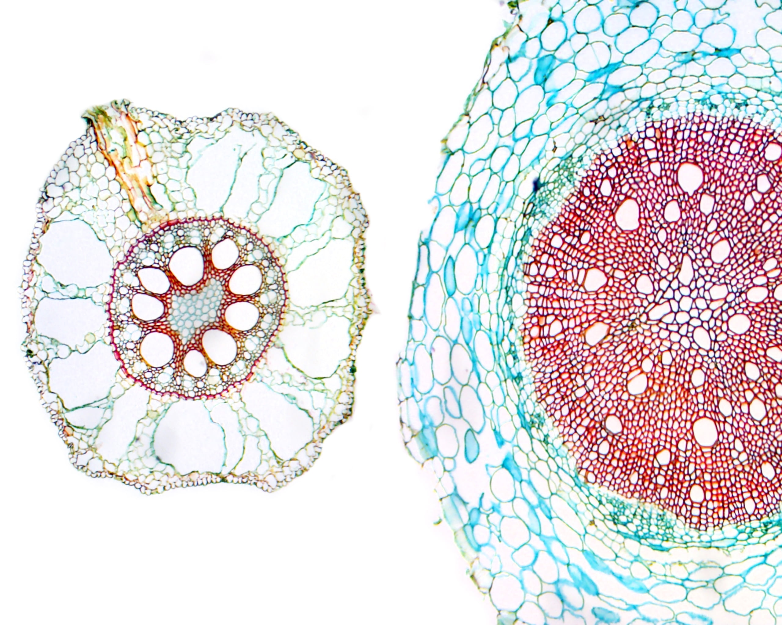 Angiosperm Root; Monocot and Dicot Comparison; Showing a Comparison of ...