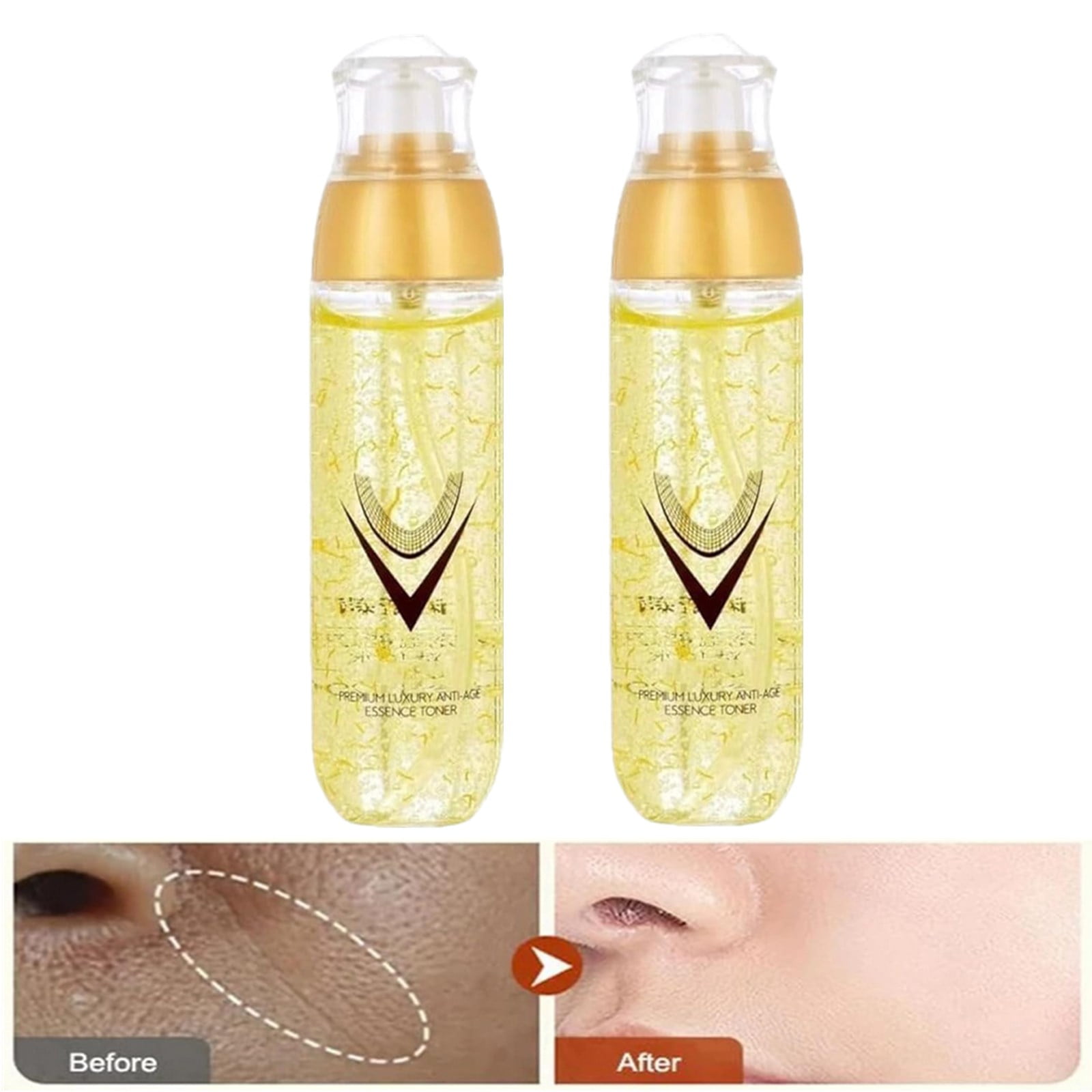 Anti-Aging Essence, Face Lift Spray, Anti Wrinkle Serum, Tighten And ...