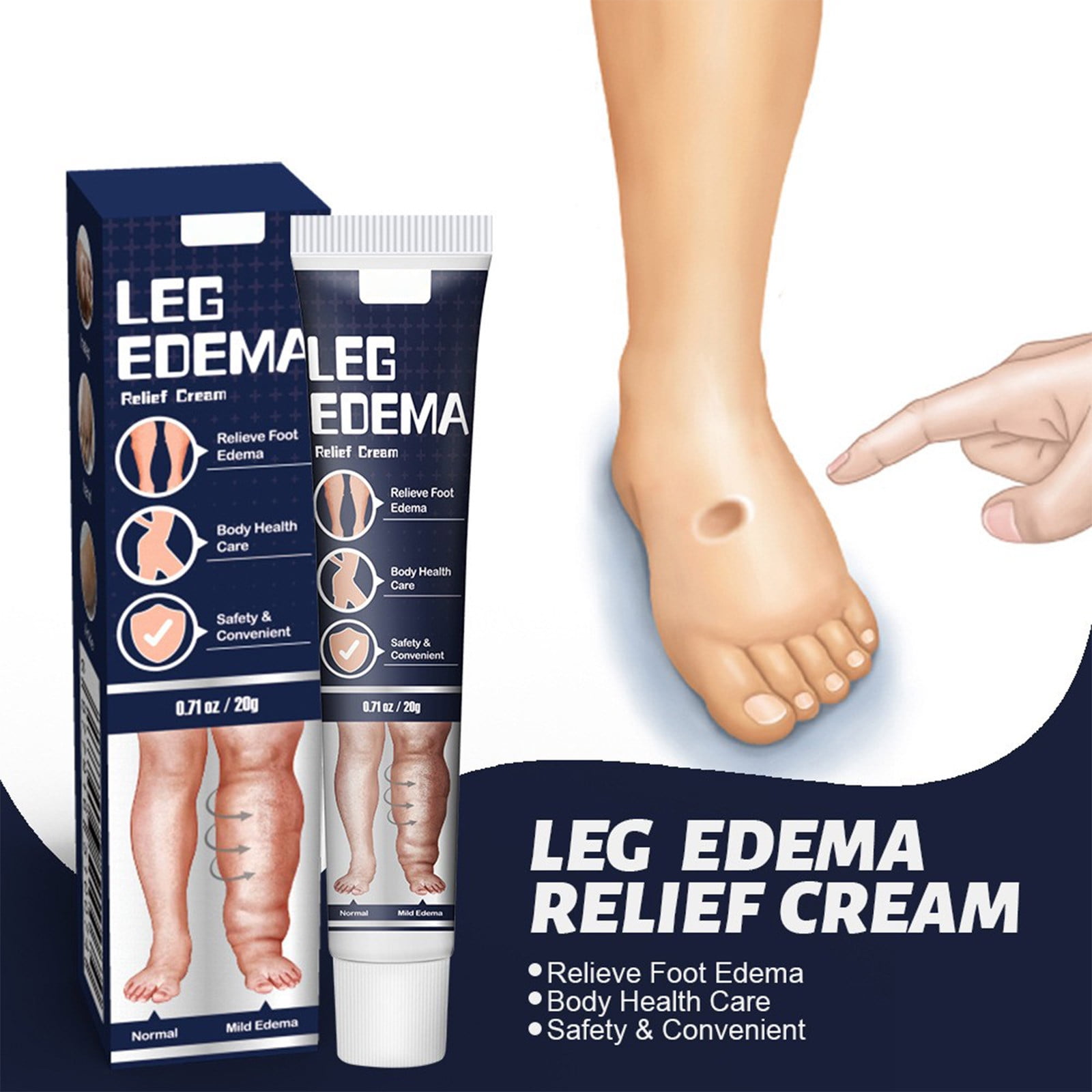 Anti-Edema Leg & Foot Cream – Swelling Relief for Calves, Arms & Ankles ...