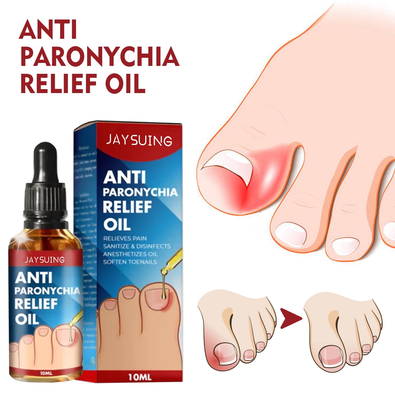 Anti Paronychia Relief Oil 10ml Soft Armor Bright Nail Repair Ingrown