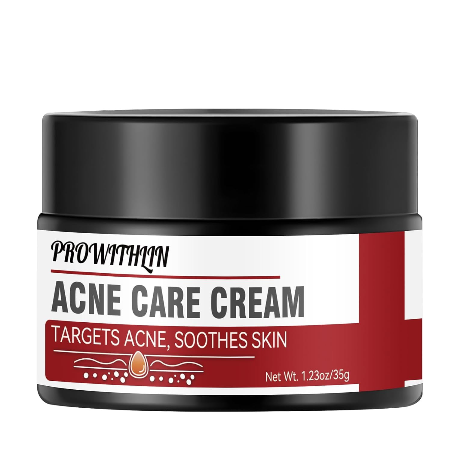 Anti Pimple Cream 30 g - Effective Acne Cream for Clarity and Skin ...