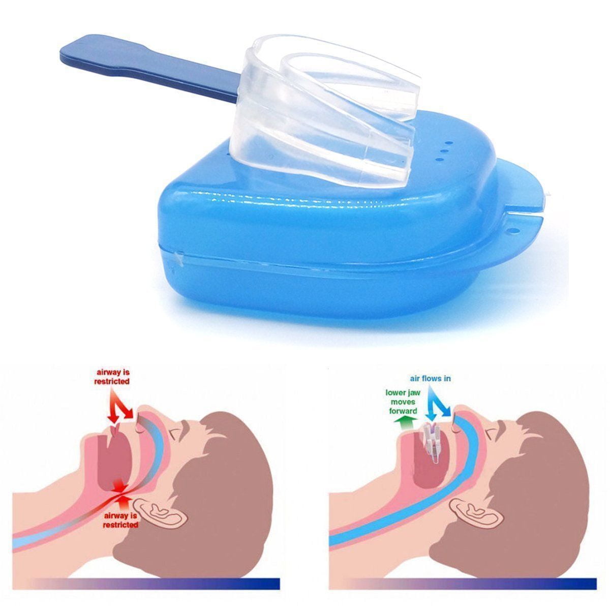 Anti Snore Mouthpiece Aid Stop Snoring Device Apnea Guard Bruxism ...