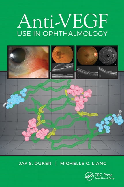 Anti-Vegf Use in Ophthalmology, (Paperback) - Walmart Business Supplies