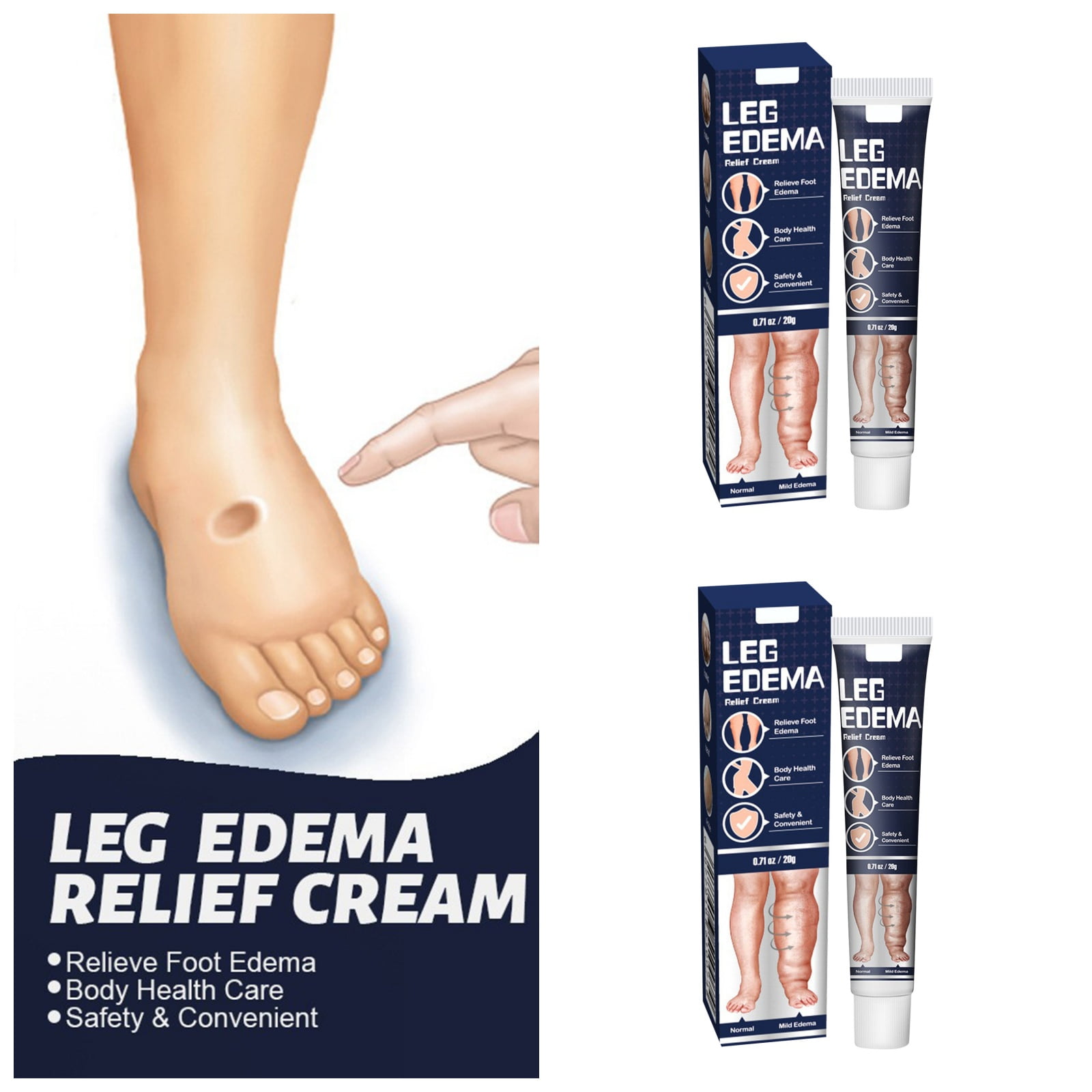 Anti-edema Cream Leg Swelling Edema Cream Arm Calf Foot Massage Health ...