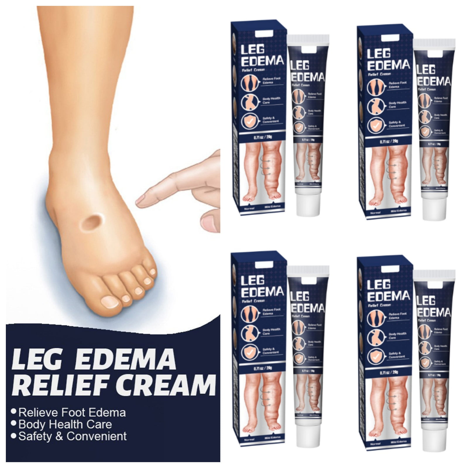Anti-edema Cream Leg Swelling Edema Cream Arm Calf Foot Massage Health ...