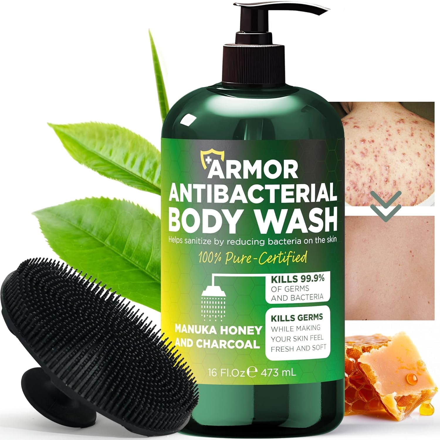 Antibacterial Body Wash | Antifungal Soap for Men & Women | Kills 99.9% ...
