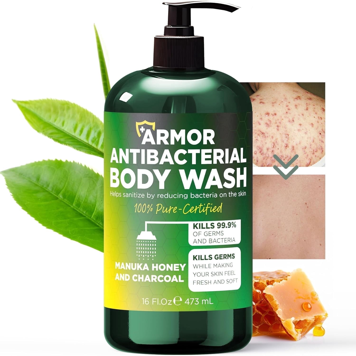 Antibacterial Body Wash | Antifungal Soap for Men & Women | Kills 99.9% ...