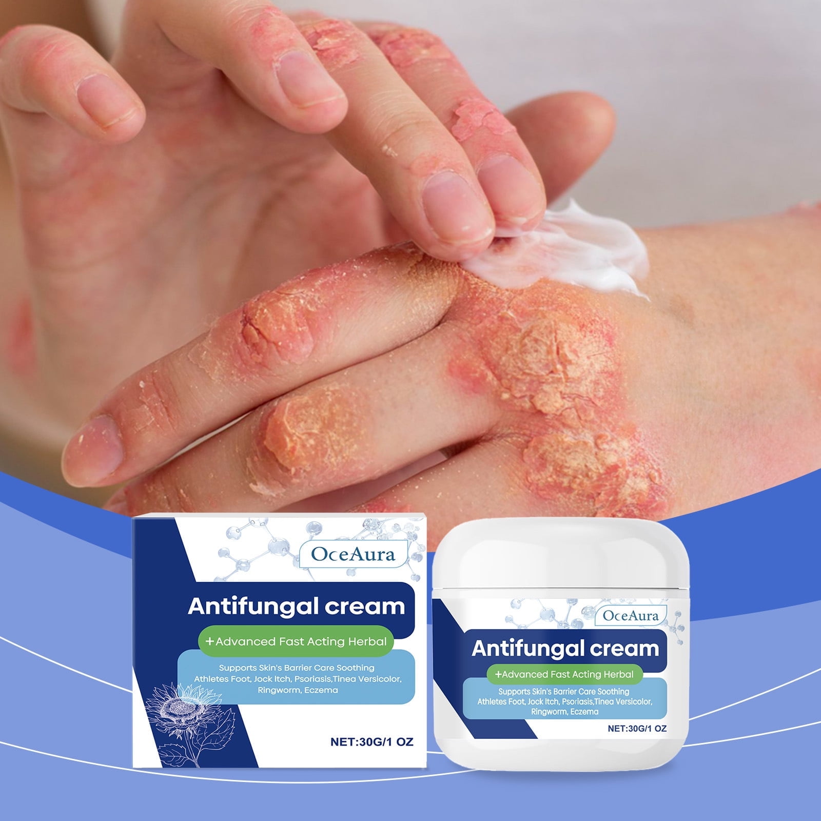 Antifungal Cream for Jock Itch: Anti Fungal Cream for Itchy Skin Relief Extra Strength ...