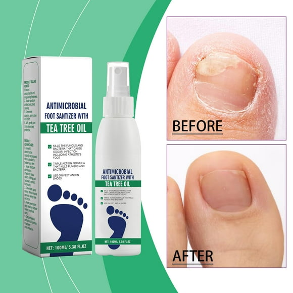 Foot Spray in Foot Care - Walmart.com