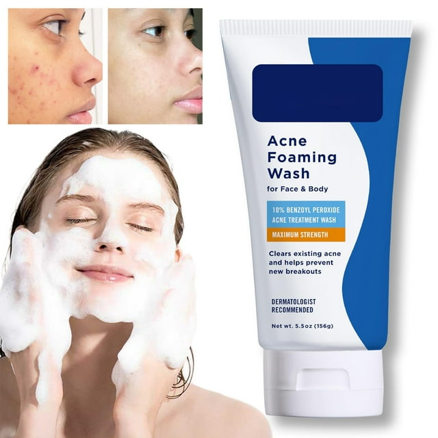 Antimicrobial Hydrating Acne Creamy Wash 4% Benzoyl Peroxide 6 OZ ...