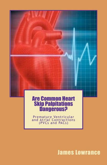 Are Common Heart Skip Palpitations Dangerous? : Premature Ventricular ...