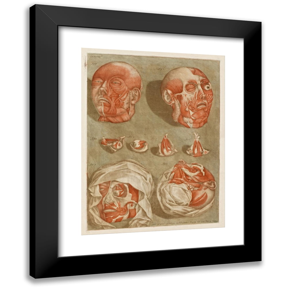 Arnauld Gautier d'Agoty 15x18 Black Modern Framed Museum Art Print ...