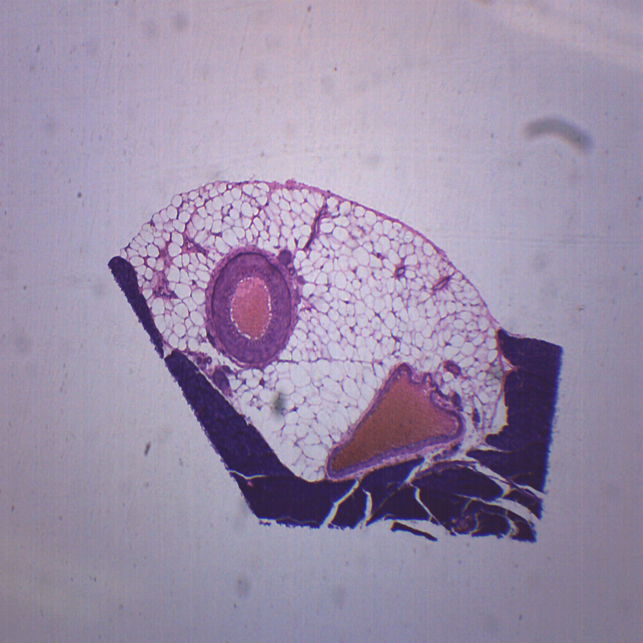 Artery, Vein & Nerve, Cross Section - Prepared Microscope Slide - 75 x ...