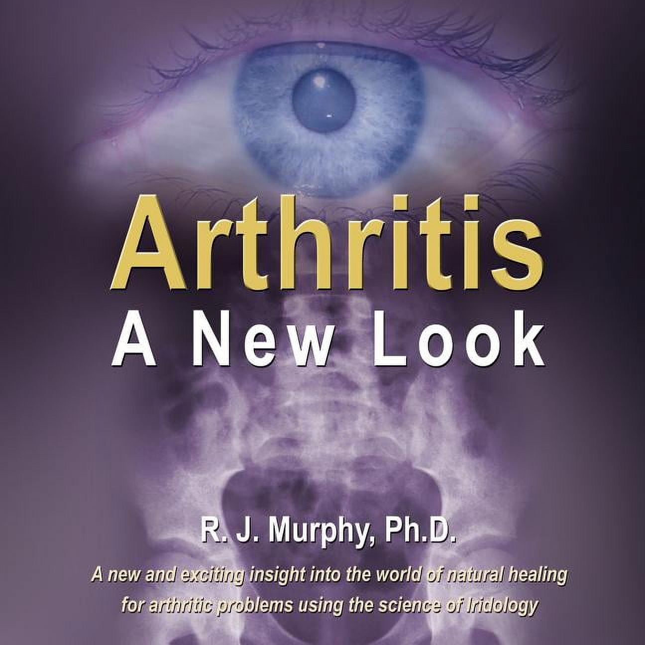 Arthritis: a New Look : Arthritic Indicators As Seen in the Eyes - Walmart.com