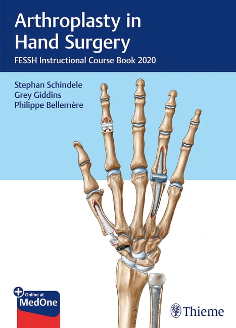 Arthroplasty in Hand Surgery: Fessh Instructional Course Book 2020 ...