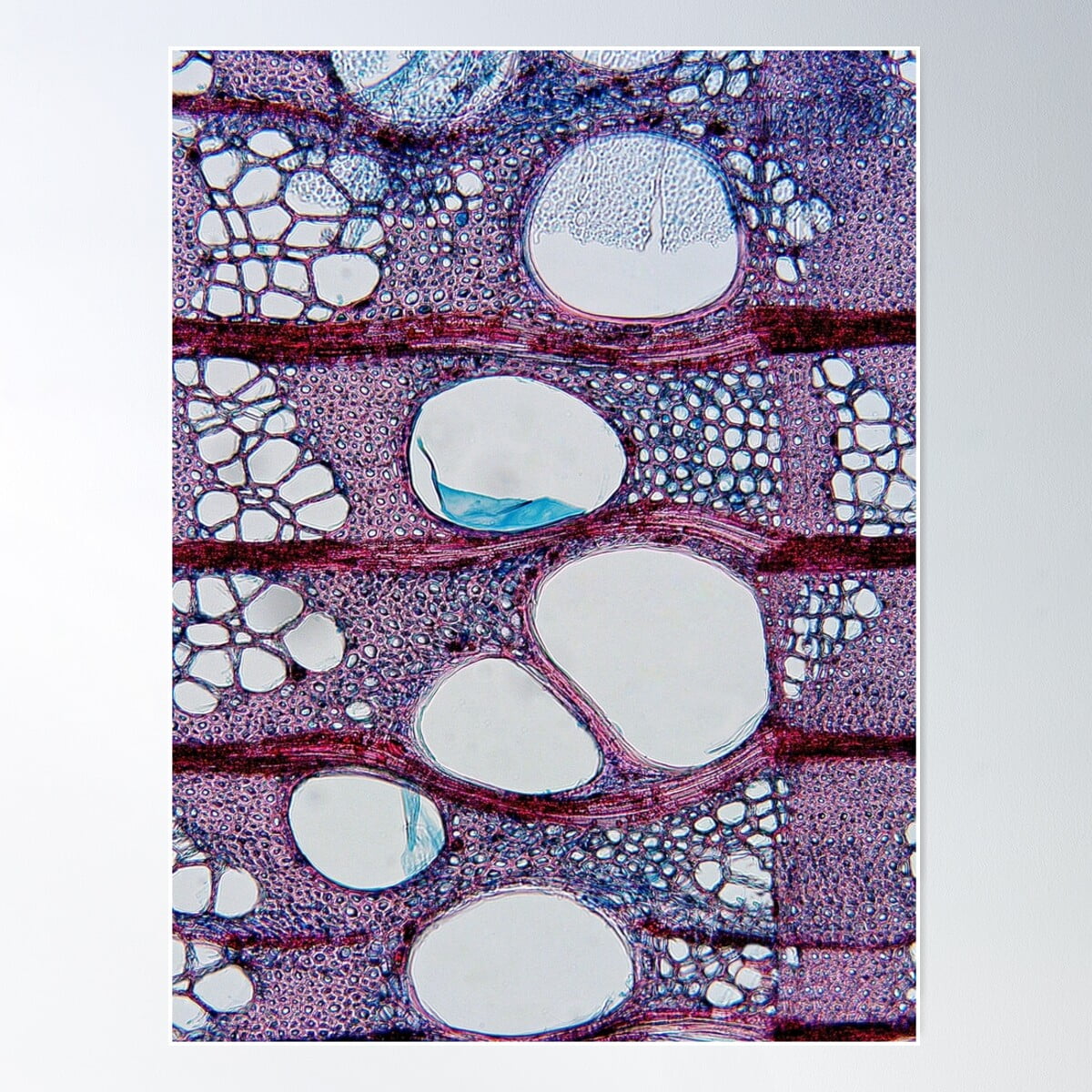 Ash Tree, Wood Cells, Cross Section; Plant Anatomy, Microscopy Poster ...