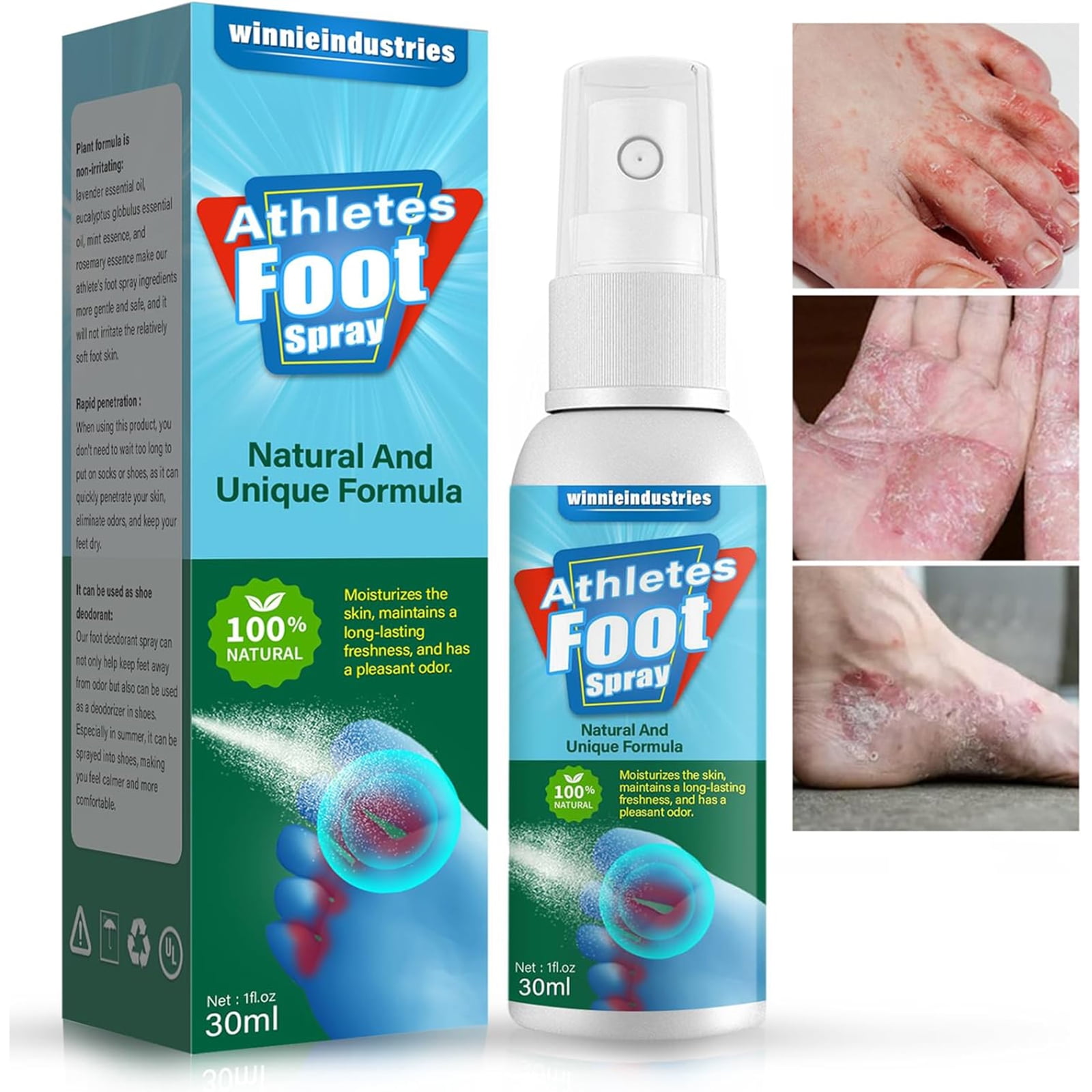 Athletes Foot Spray, Antifungal Spray Athletes Foot Treatment, Anti ...
