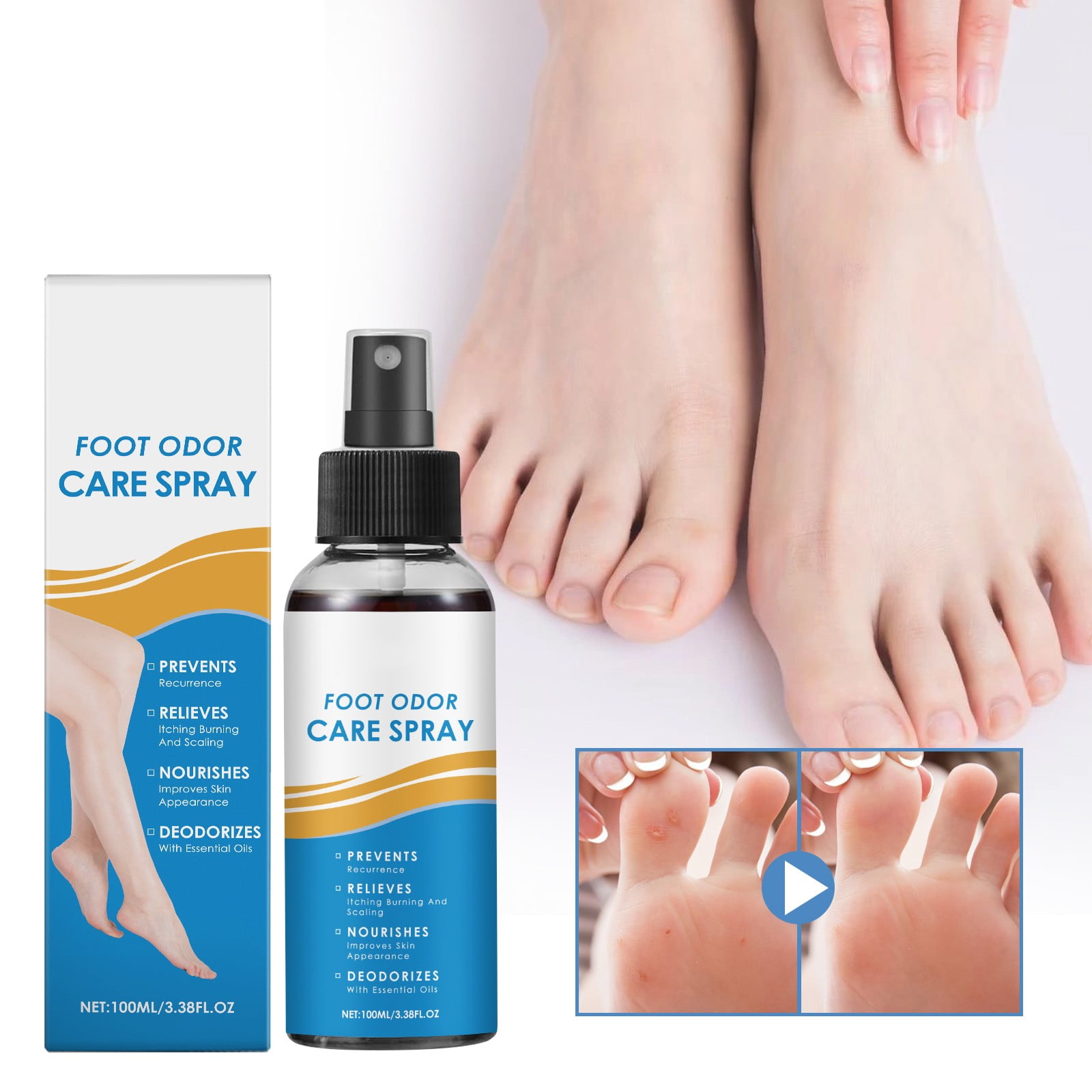 Athletes Foot Spray, Athletes Foot Fungi Spray, Foot Fungi Treating ...