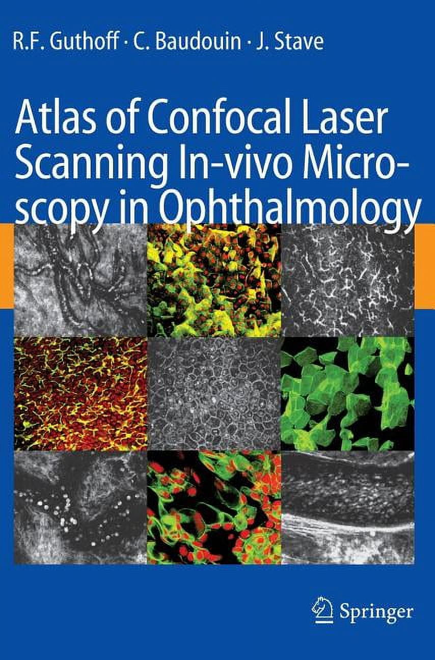 Atlas of Confocal Laser Scanning In-Vivo Microscopy in Ophthalmology ...