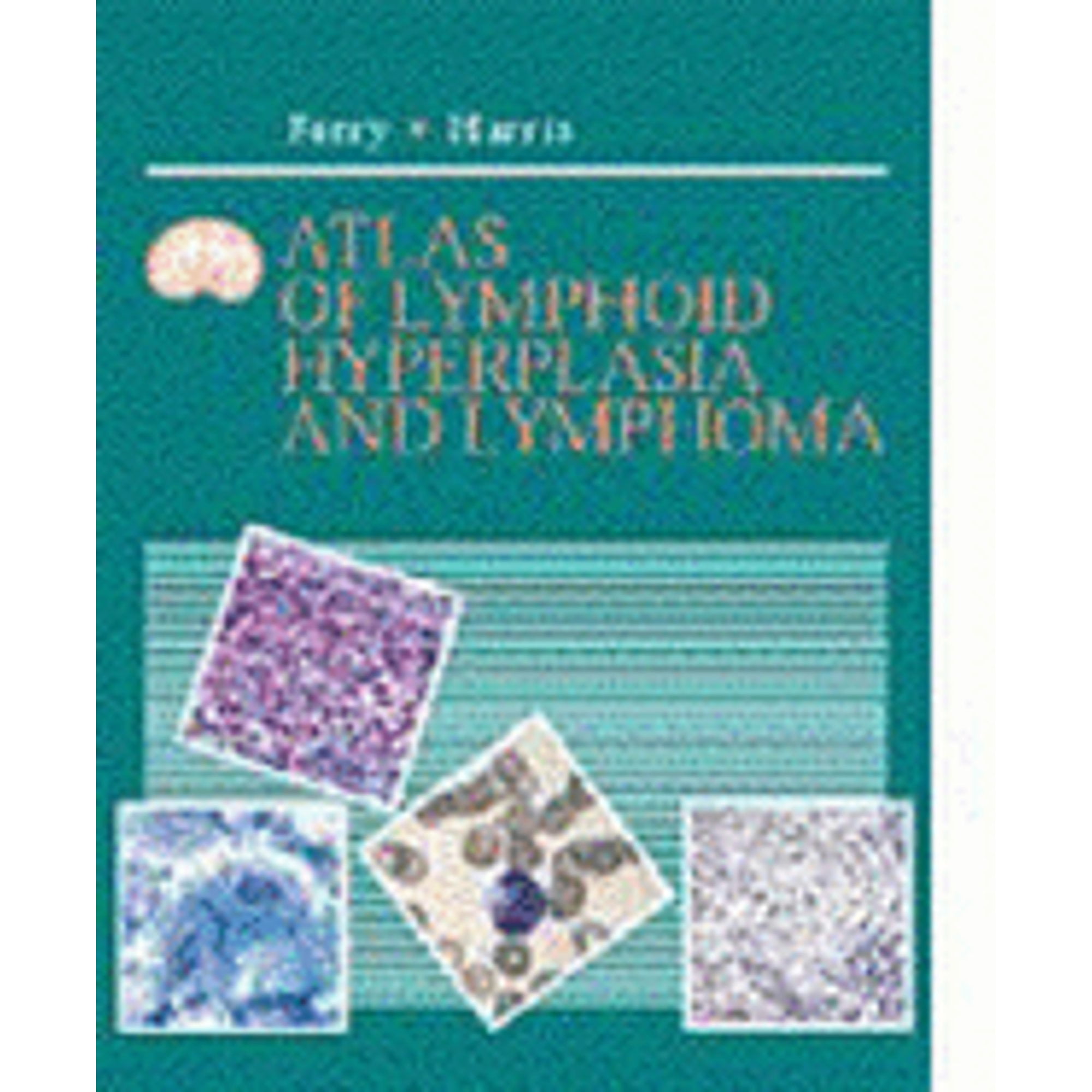 Pre-Owned Atlas of Lymphoid Hyperplasia and Lymphoma: A Volume in the ...