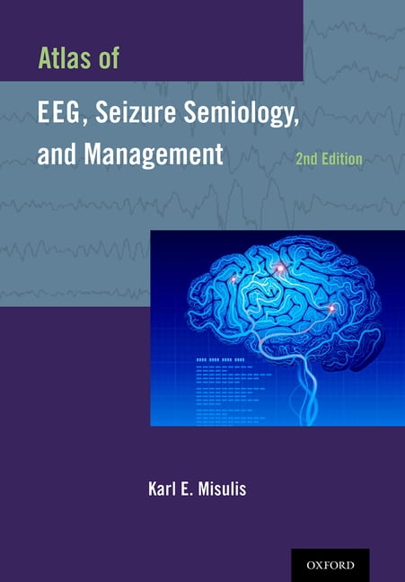 Atlas of EEG, Seizure Semiology, and Management, (Hardcover) - Walmart.com