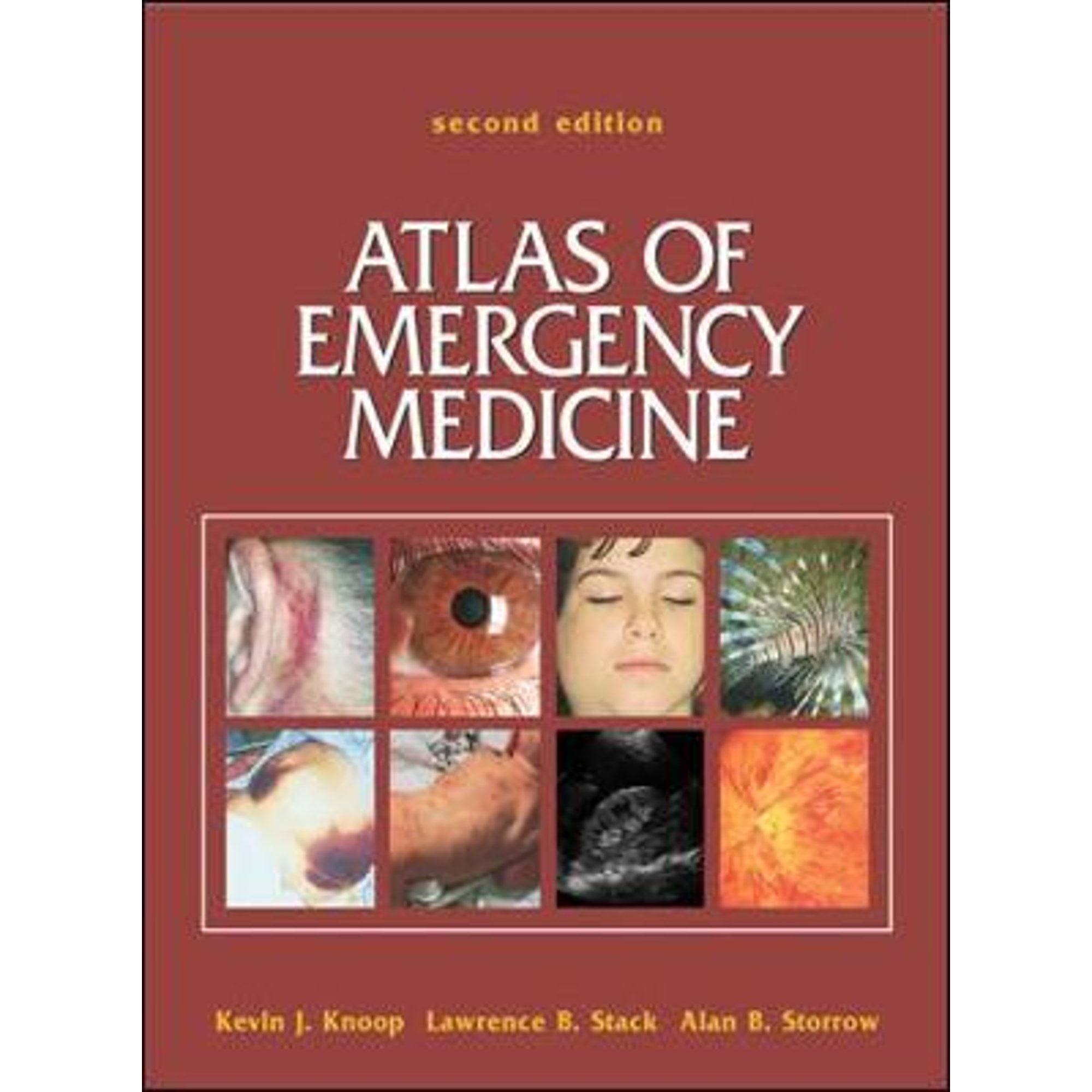 Pre-Owned Atlas of Emergency Medicine Hardcover - Walmart.com