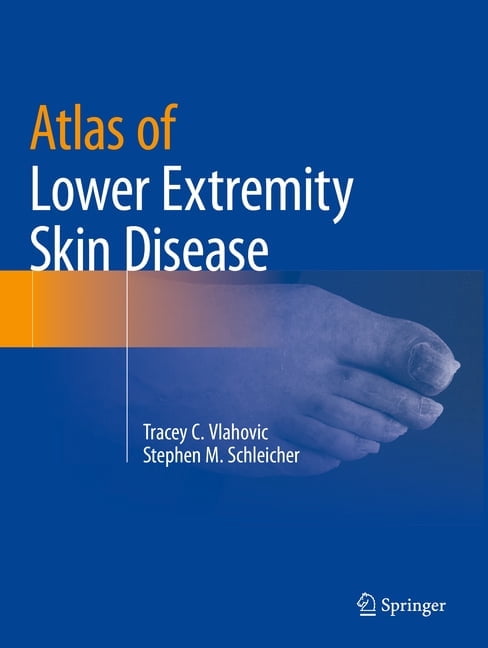 Atlas of Lower Extremity Skin Disease, (Paperback) - Walmart Business ...