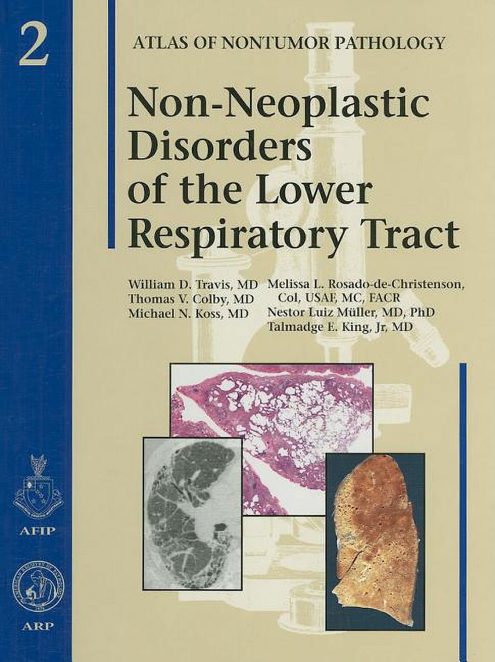 Atlas of Nontumor Pathology: Non-Neoplastic Disorders of the Lower Respiratory Tract (Hardcover ...