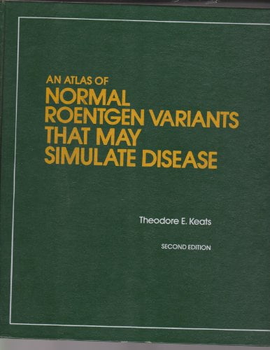 Pre-Owned Atlas of Normal Roentgen Variants That May Simulate Disease ...