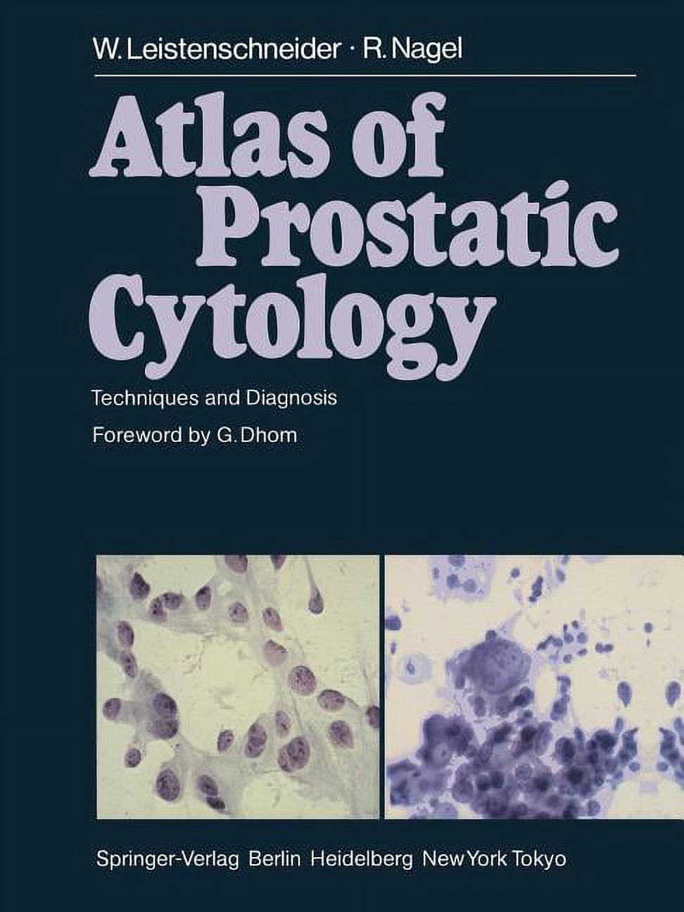 Atlas of Prostatic Cytology: Techniques and Diagnosis, (Paperback ...