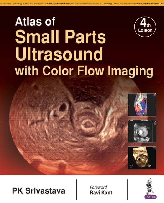 Atlas of Small Parts Ultrasound: with Color Flow Imaging (Hardcover) by ...