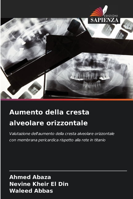Aumento della cresta alveolare orizzontale (Paperback) - Walmart.com