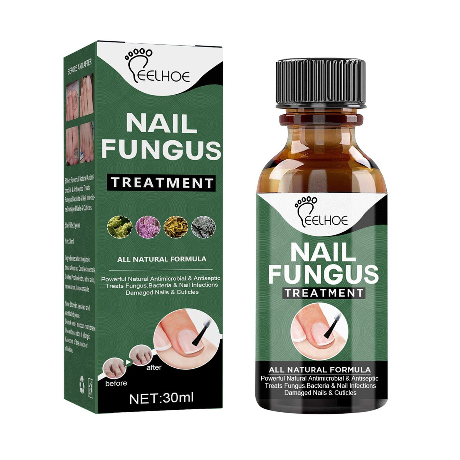 Aura Extra Strength Nail Repair Liquid Toenail Nail Solution Toenails ...