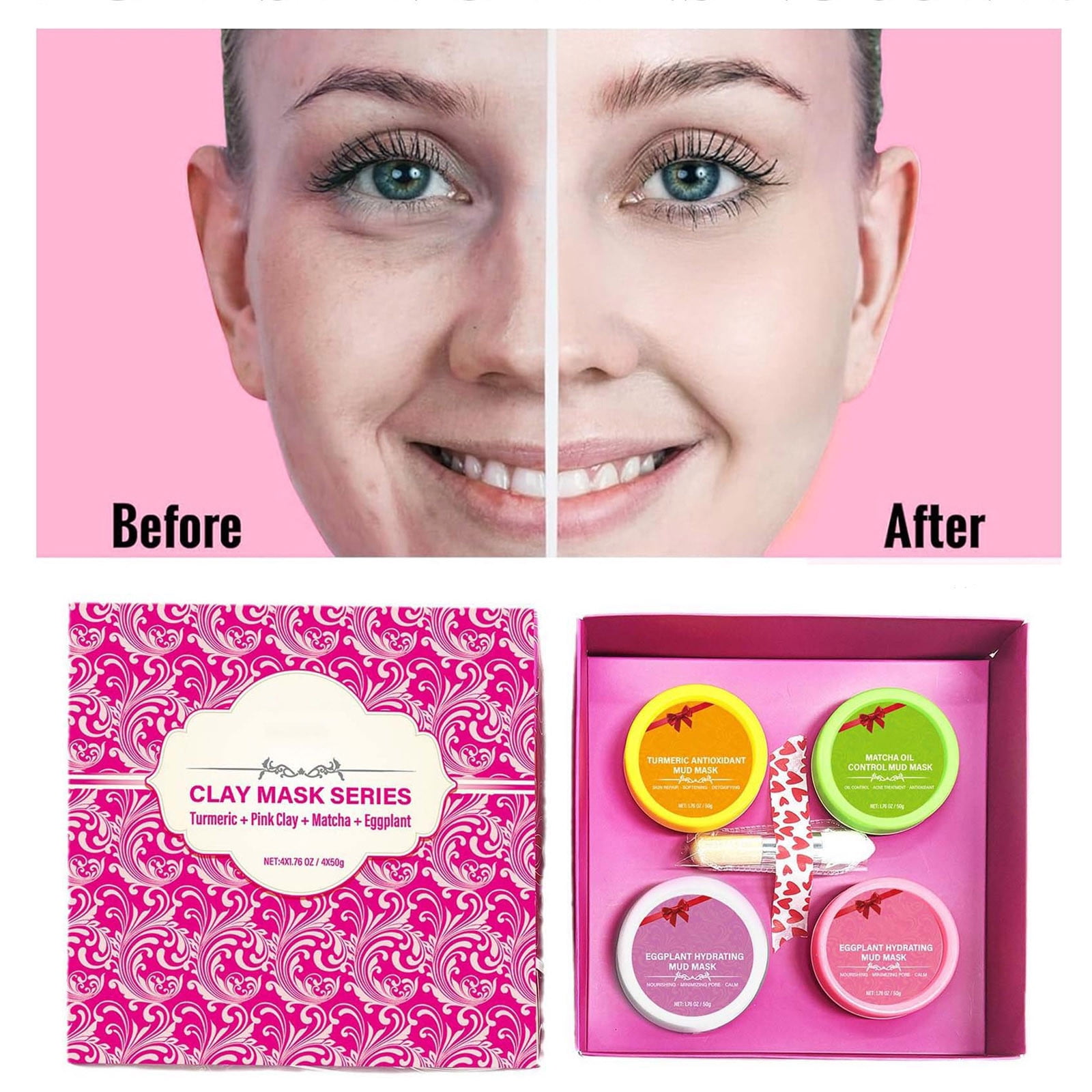 Aursykel Deep Cleansing Mud Facial Mask Set for Blackhead Eliminate ...