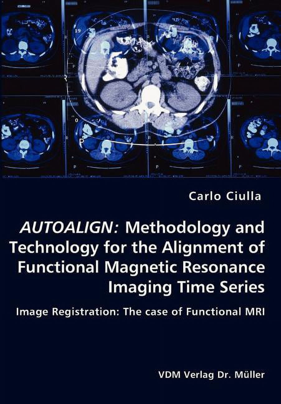 Autoalign: Methodology and Technology for the Alignment of Functional ...