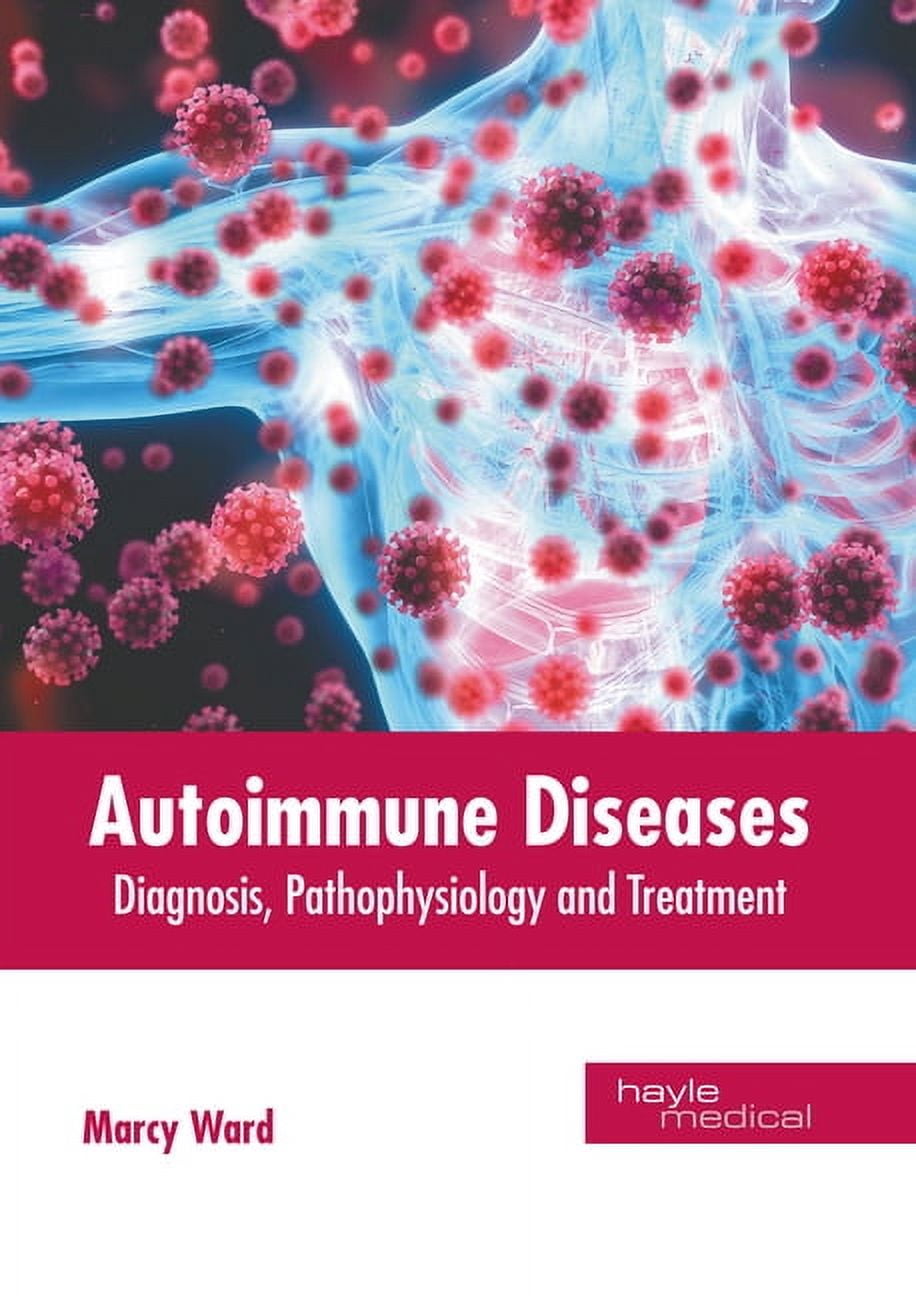 Autoimmune Diseases: Diagnosis, Pathophysiology and Treatment ...