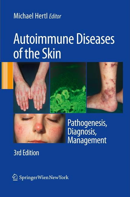 Autoimmune Diseases of the Skin: Pathogenesis, Diagnosis, Management ...