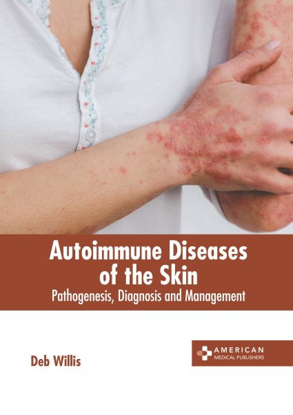 Autoimmune Diseases of the Skin: Pathogenesis, Diagnosis and Management ...